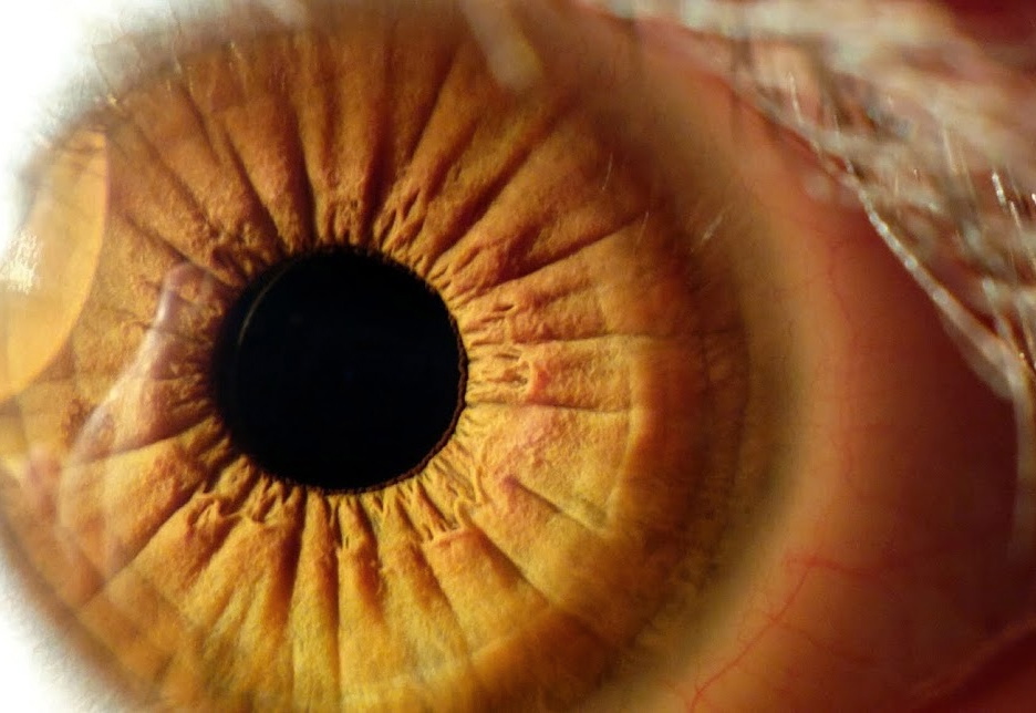 Los colores de ojos más originales de todo el mundo - Mundo.com